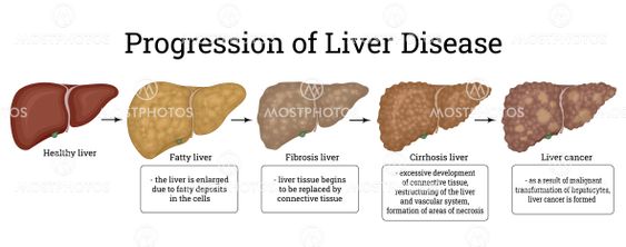 What Are The Stages Of Liver Failure In Dogs