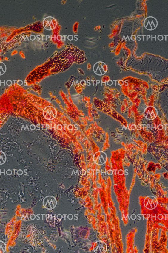 "micrograph of insects body..." av Xunbin Pan - Mostphotos