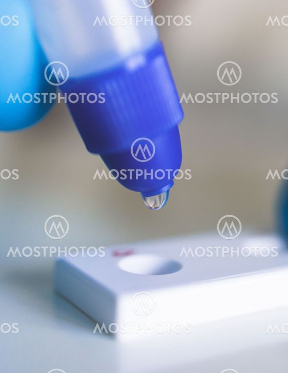 "Process of express fast cor..." av Nikolai Tsuguliev - Mostphotos