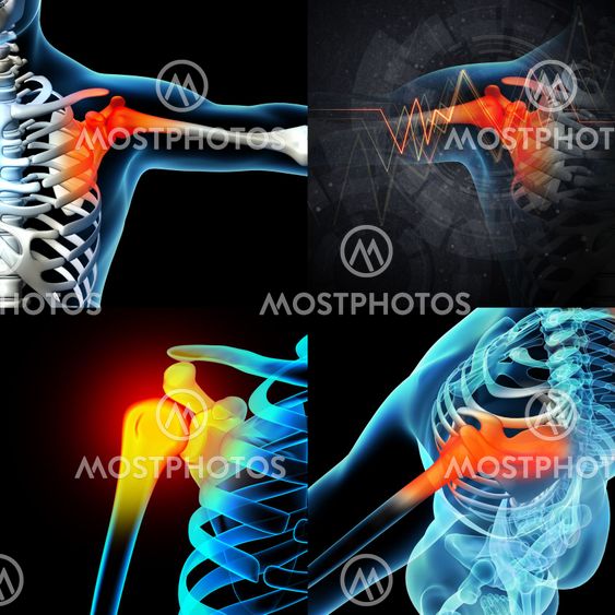 "3D rendering human shoulder..." by User_54848 - Mostphotos
