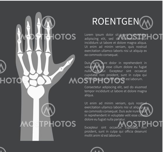 "Roentgen Poster and Text, V..." by robuart - Mostphotos